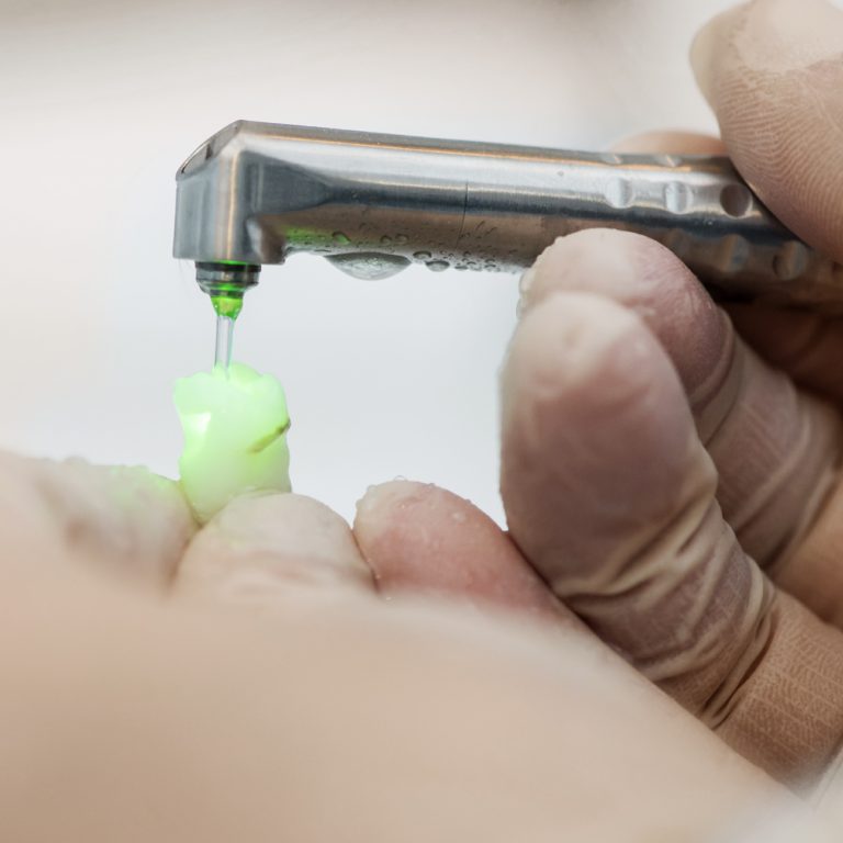 Laser Behandlung | Zahnarzt in Neufahrn - Dr. Ortel und Dr. Tölge